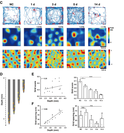 Implantable Brain-Machine Interface Detects Neuronal Damage in Spatial ...