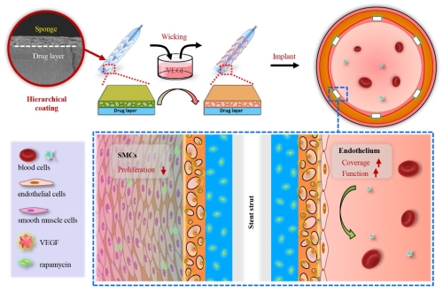 Hierarchical capillary coating to biofunctionlize drug-eluting stent ...