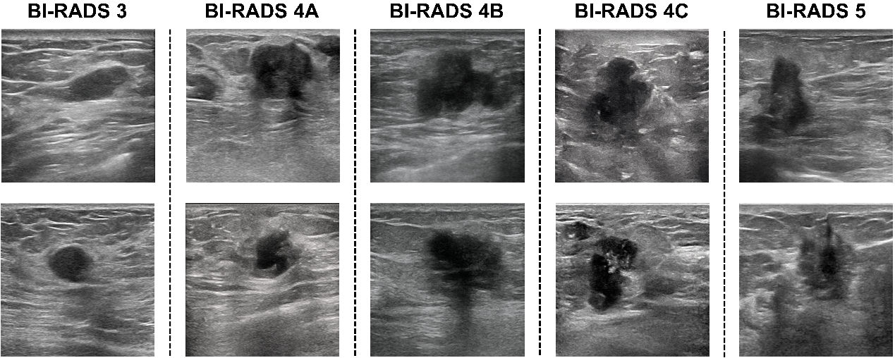 Synthetic Breast Ultrasound Images: A Study to Overcome Medical Data ...