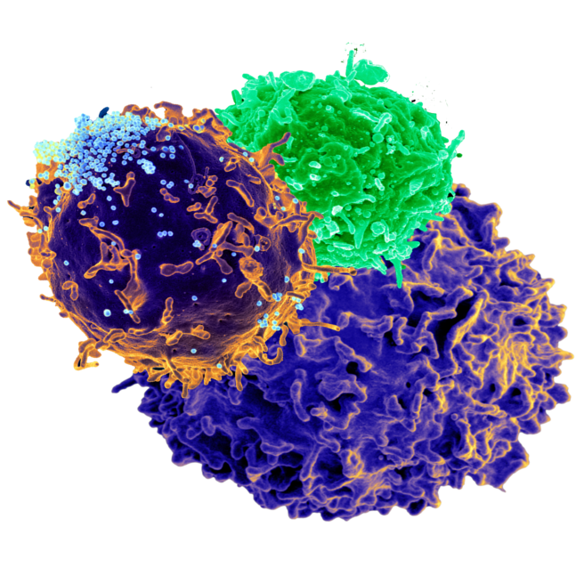 A Promising Therapeutic Target for Autoimmune Diseases Like Multiple ...